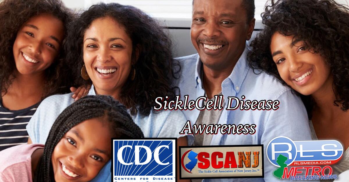 VIDEO: Center for Disease Control (CDC) Explains Sickle Cell Disease