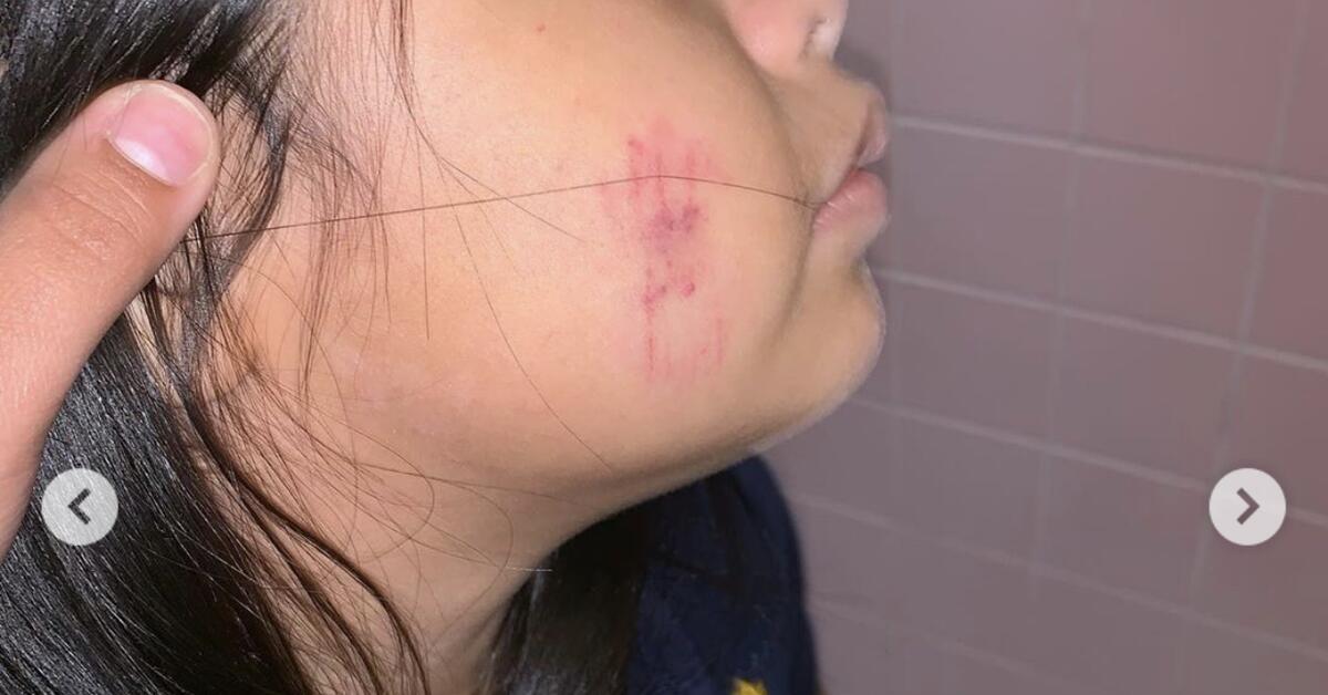 Elizabeth School Officials Respond to Alleged Assault of Special Needs ...